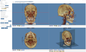 Dolphin Imaging Distributor – Dolphin Imaging Authorized Exclusive ...