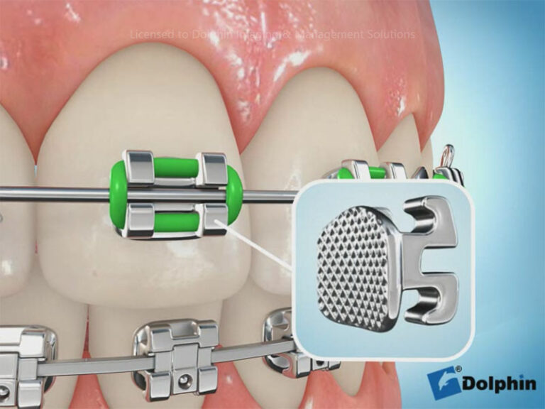 Dolphin Imaging Distributor – Dolphin Imaging Authorized Exclusive ...